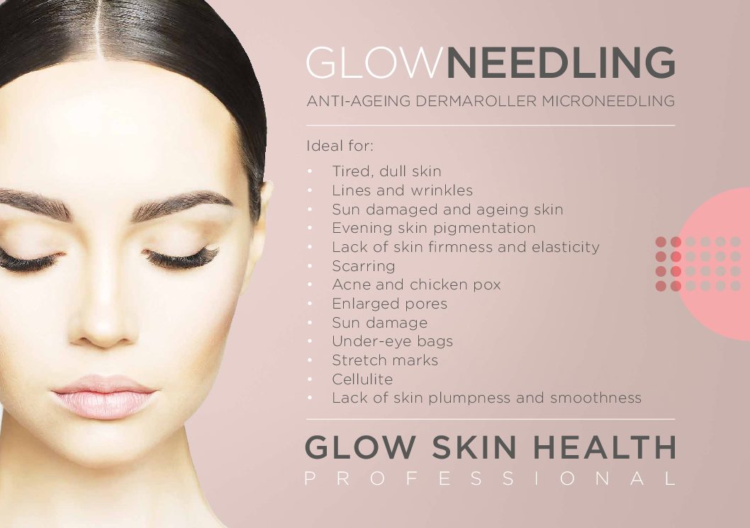 Glow Needling A5 Leaflet - Glow Skin Health